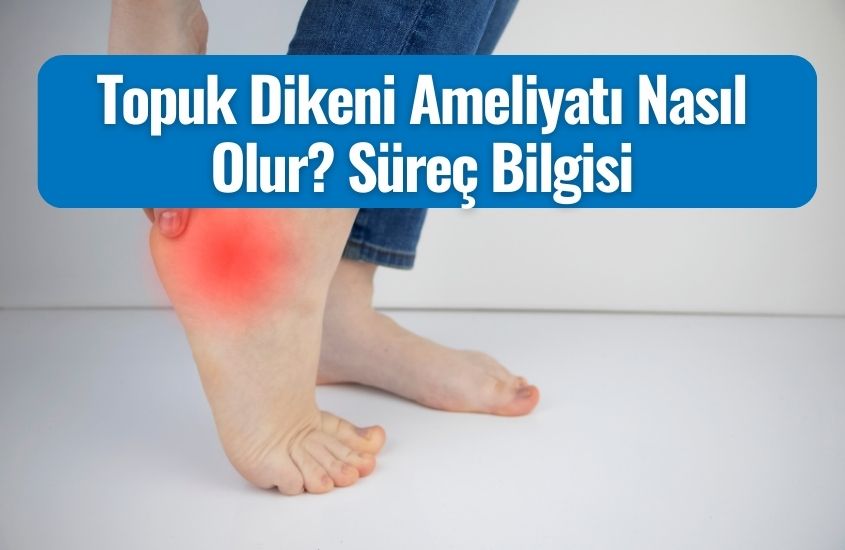 Topuk Dikeni Ameliyatı Nasıl Olur? Süreç Bilgisi | Akademi Danışmanı